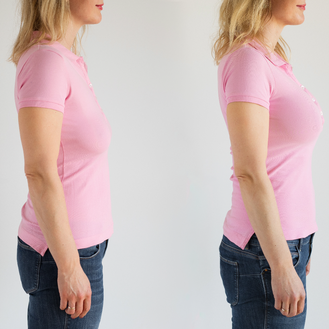 Non Surgical Breast Lift Artistry Clinic